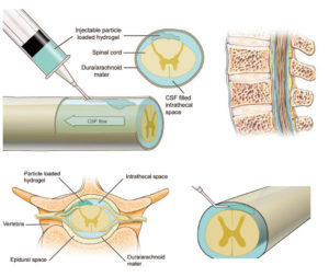 Research – Shoichet Lab